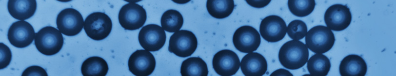 Dispersed Two-Phase Flows - SHF - Société Hydrotechnique de France